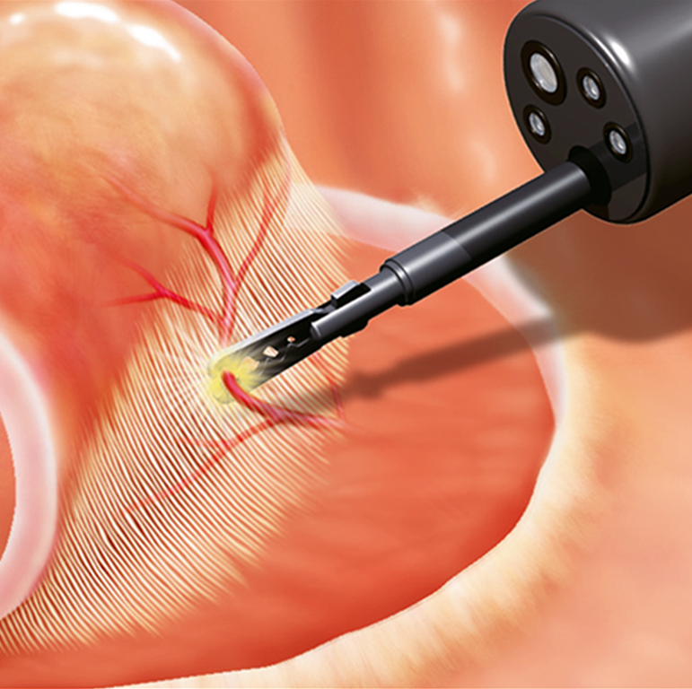 Clutch Cutter Scissors 00ZCLUTCHCUTTER | C.R. Kennedy Medical Solutions