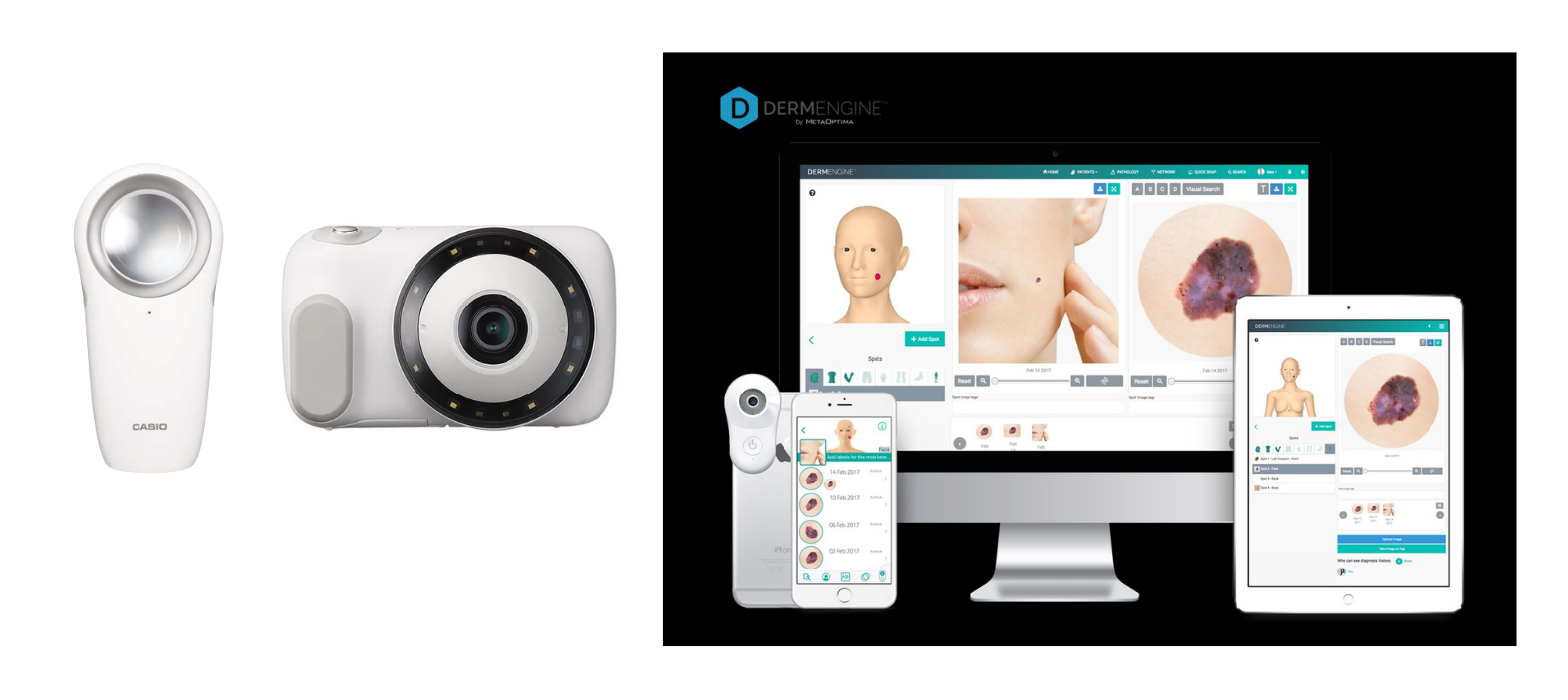 CASIO DZ-D100 x DermEngine Press Release | C.R. Kennedy Medical Solutions